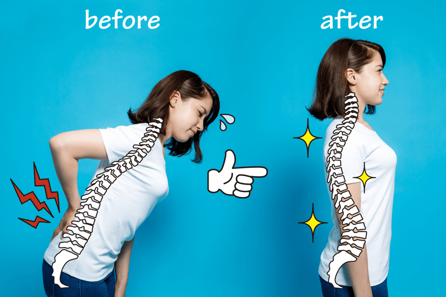 How Should Your Fitness Center be Conducting a Posture Analysis?