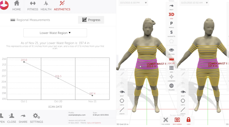 Styku - The Leading 3D Body Scanner