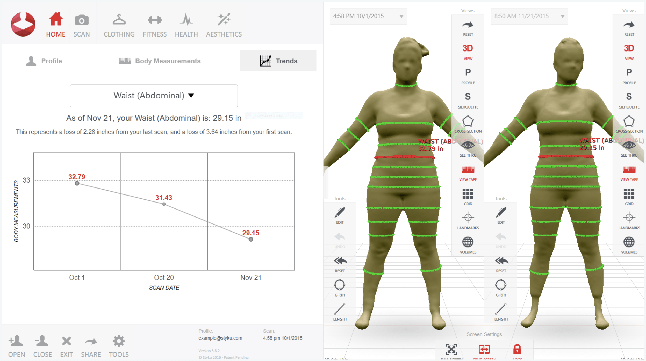 Styku: 3D body scanning and shape analysis for Fitness, Health, Apparel ...